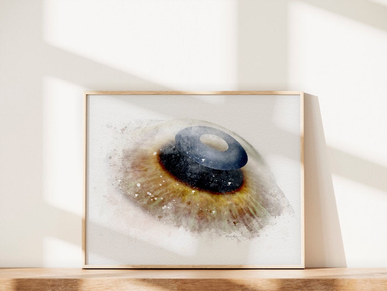Cornea Doctor Gift KAMRA Inlay Corneal Implant Watercolor Style Art ...