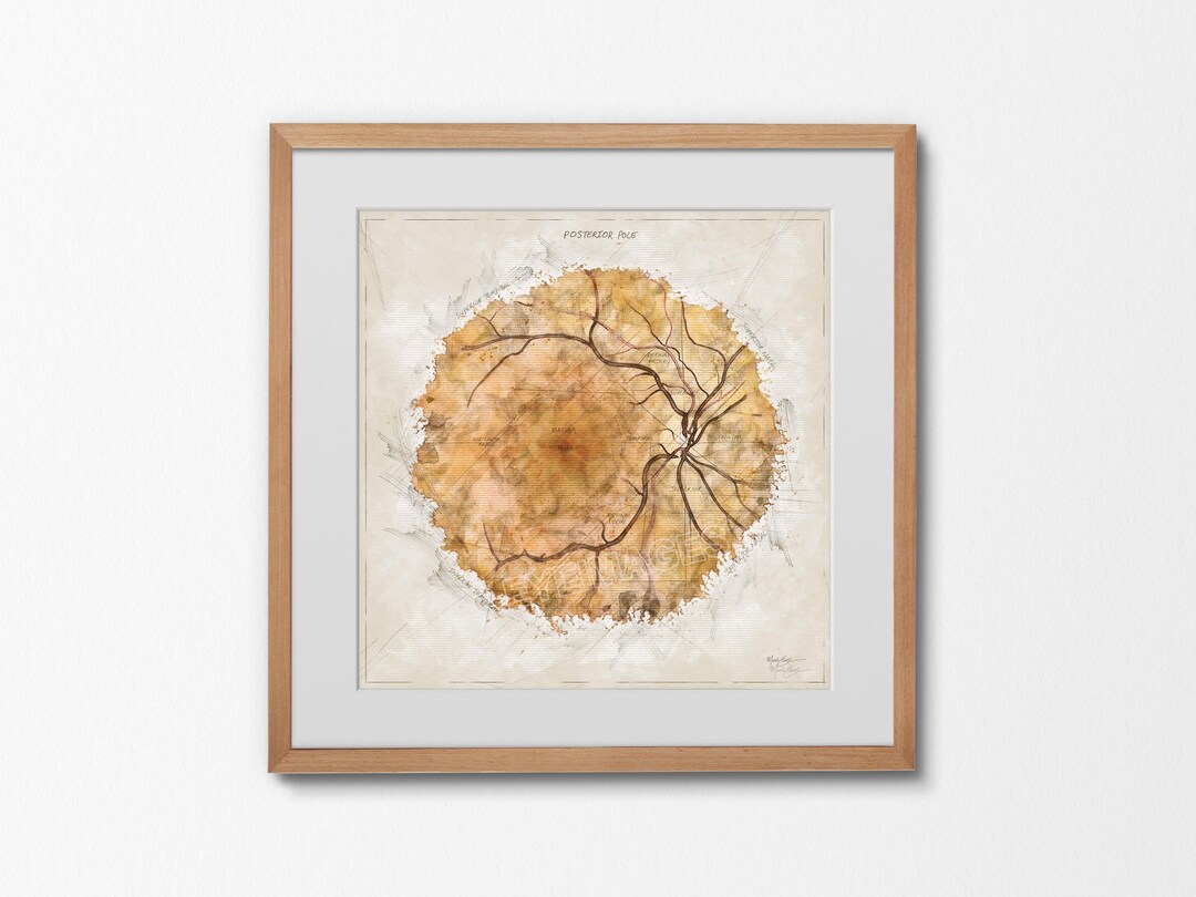 Optometry Graduation Gift, Custom Eye Wall Decor. Retina Schematic Eye ...