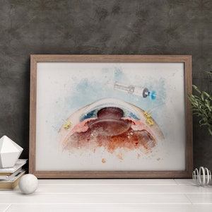 Retina Surgery Art Ophthalmologist Gift Retina Specialist Gift ...
