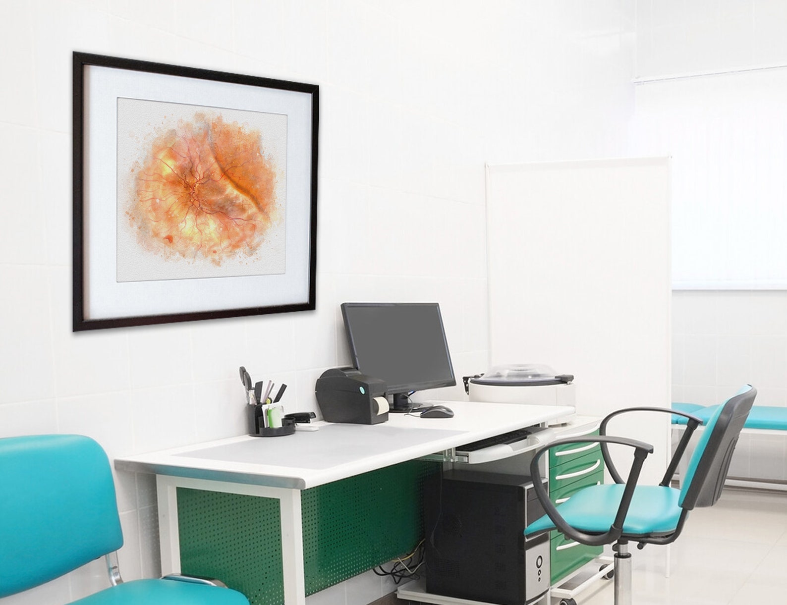 Eye Doctor Gift Retinal Detachment Watercolor-style Painting Retina Art ...