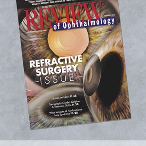 Cornea Doctor Gift KAMRA Inlay Corneal Implant Watercolor Style Art ...