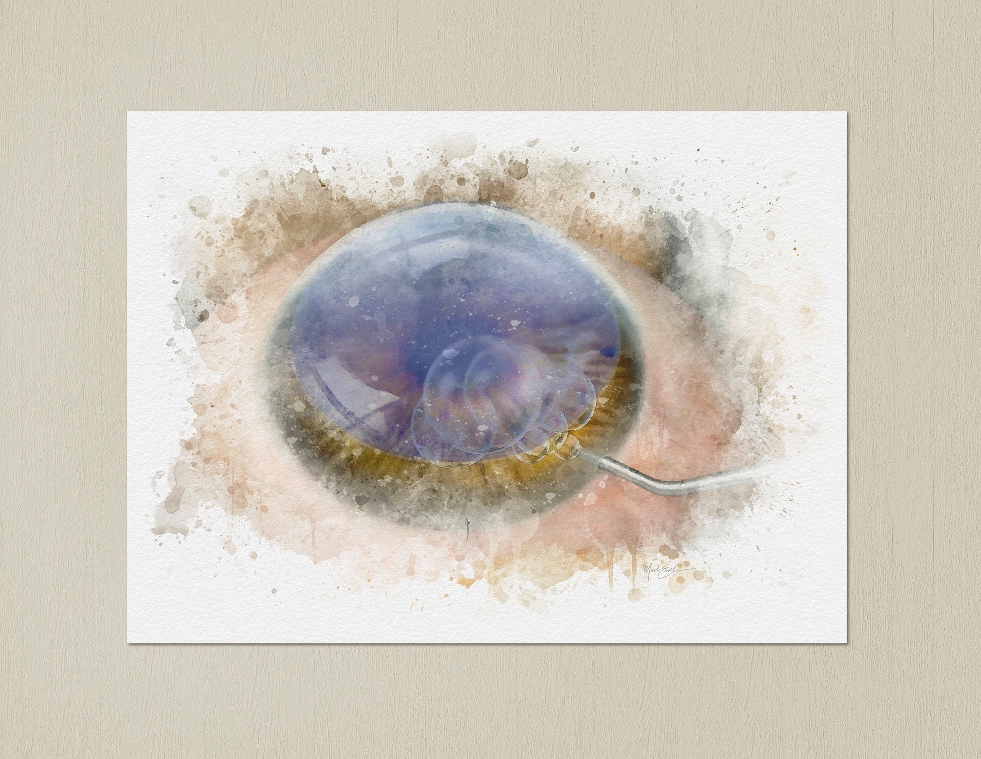 Cornea Doctor Gift, DMEK Watercolor Style Art Print for Eye Surgeon ...