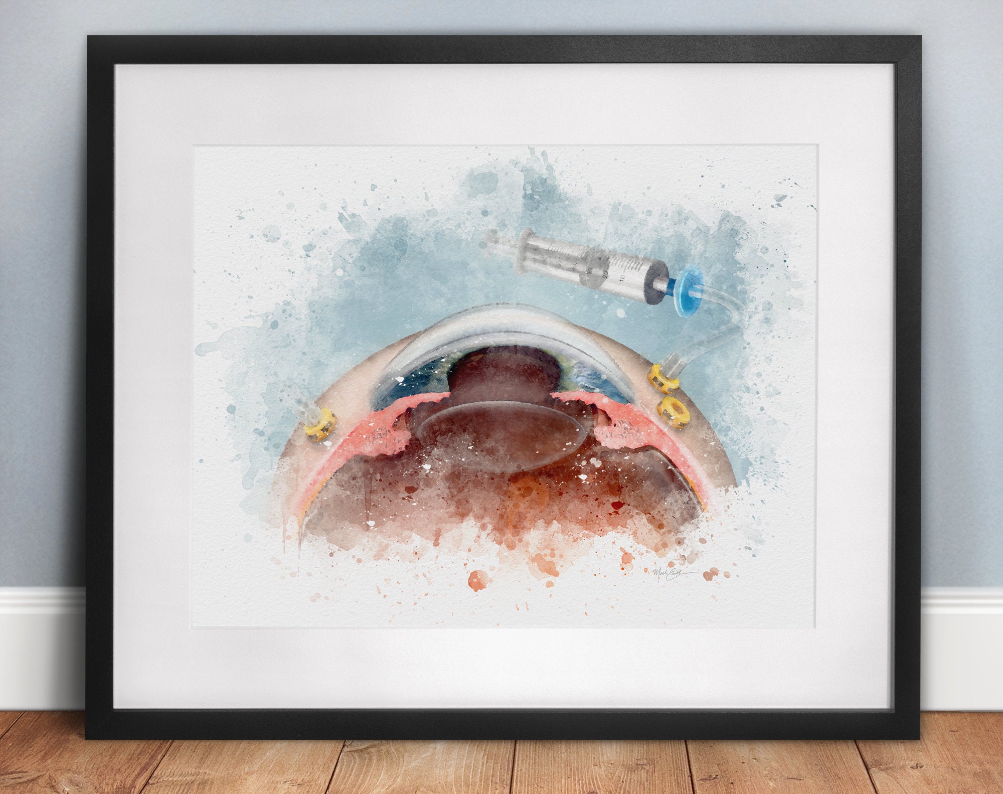 Retina Surgery Art Ophthalmologist Gift Retina Specialist - Etsy