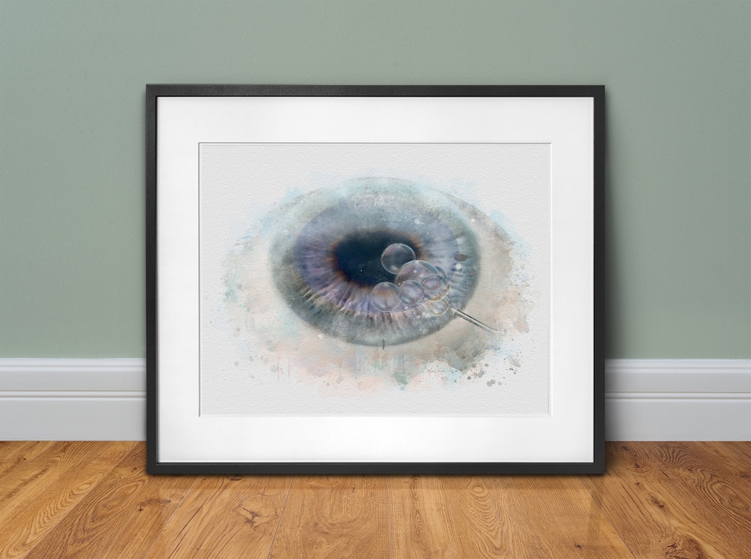 Eye Surgeon Gift, DMEK Eye Doctor Art Print Watercolor Style Eye ...