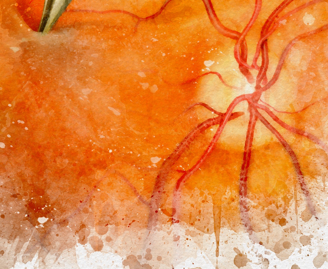 Retina Doctor Gift, Retina Art Print, Retina Surgery Wall Décor ...