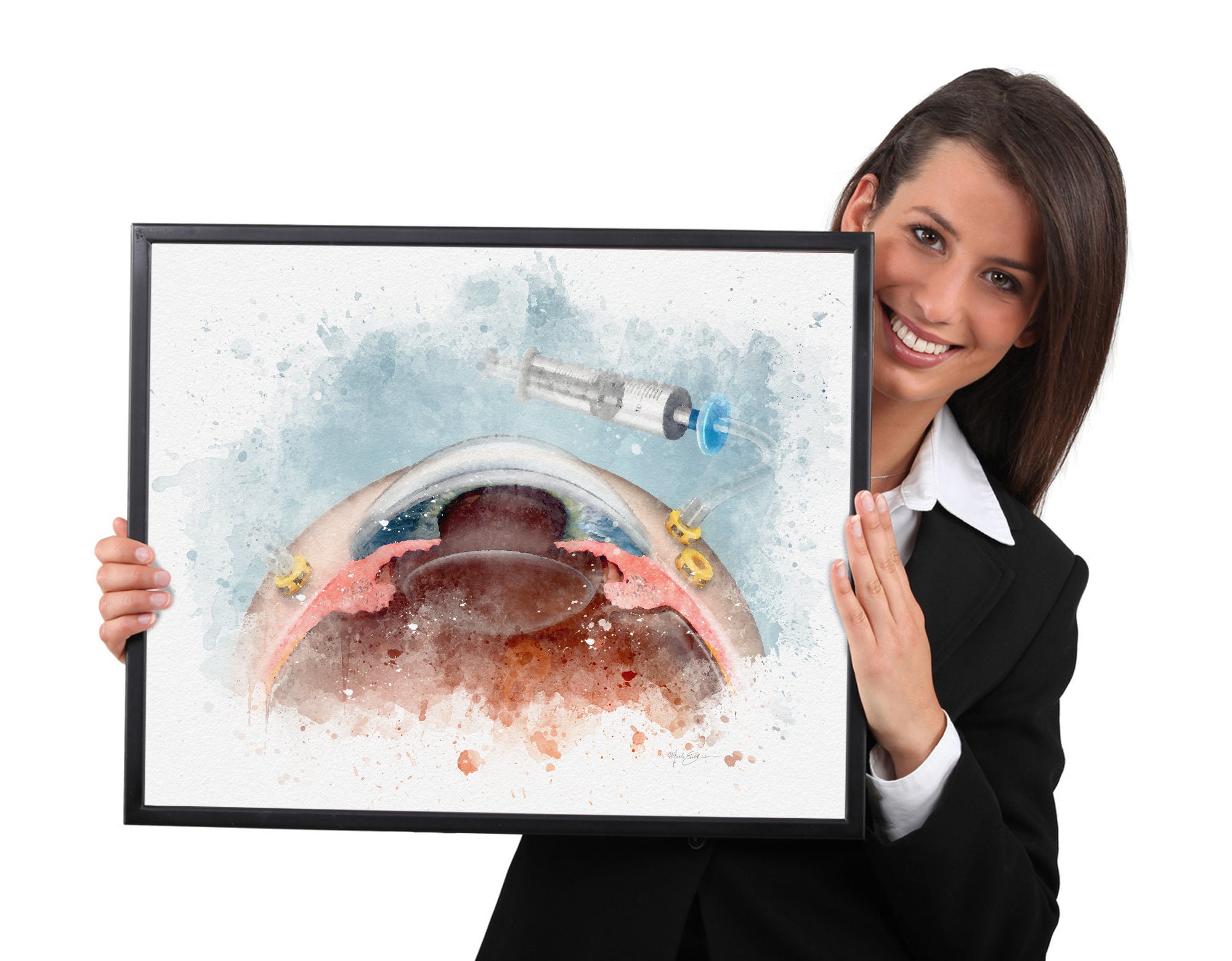 Retina Surgery Art Ophthalmologist Gift Retina Specialist - Etsy