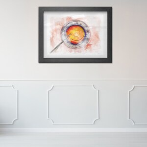 Cataract Doctor Gift, Cataract and IOL Lens Positioning, Cataract ...