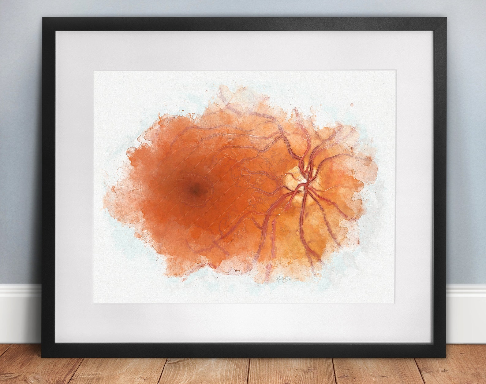 Retina Anatomy Art Print Mixed Media Style Ophthalmologist - Etsy