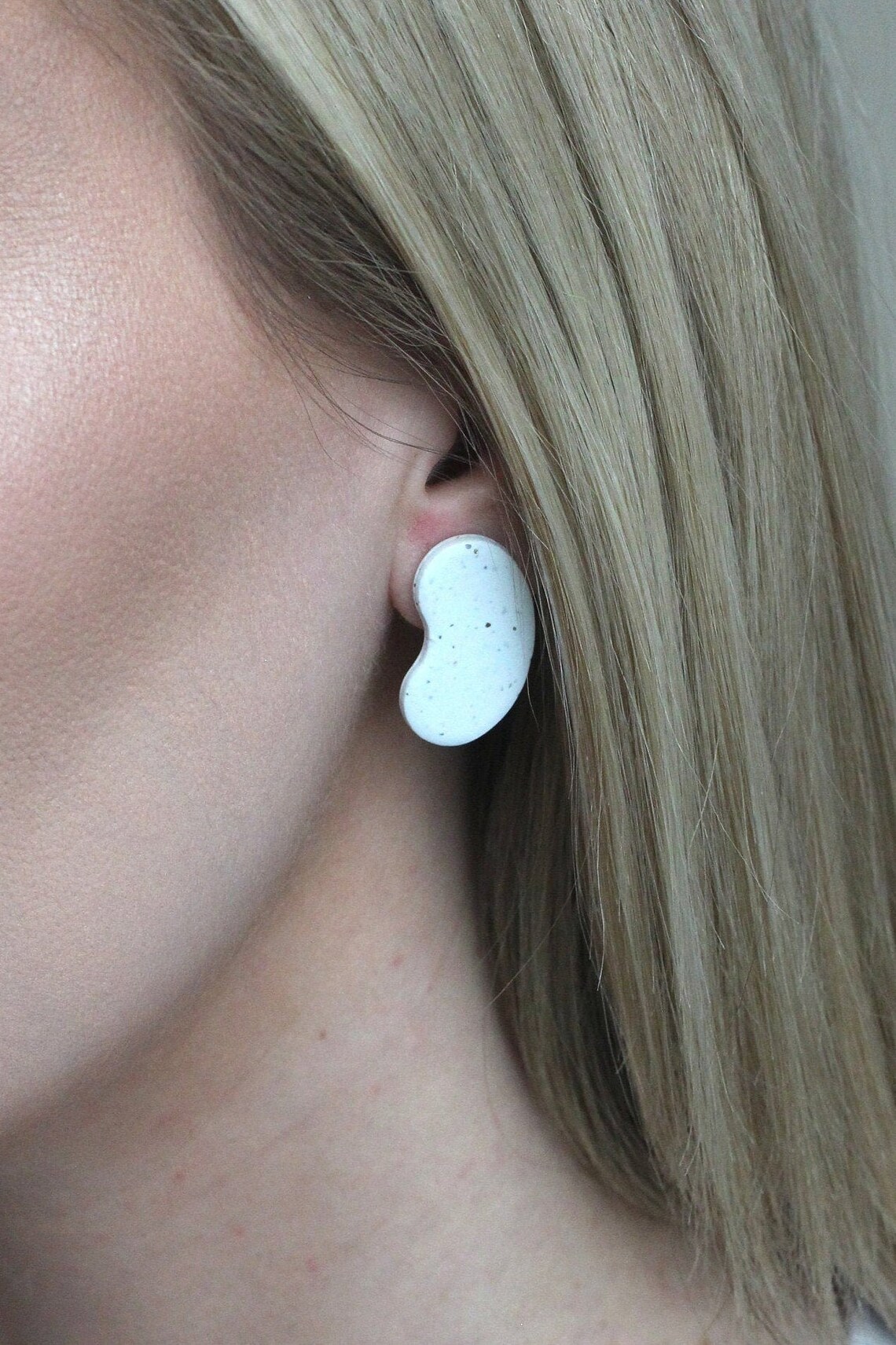 Stoned kidney Stone / Renal Calculi Earrings Handmade From | Etsy