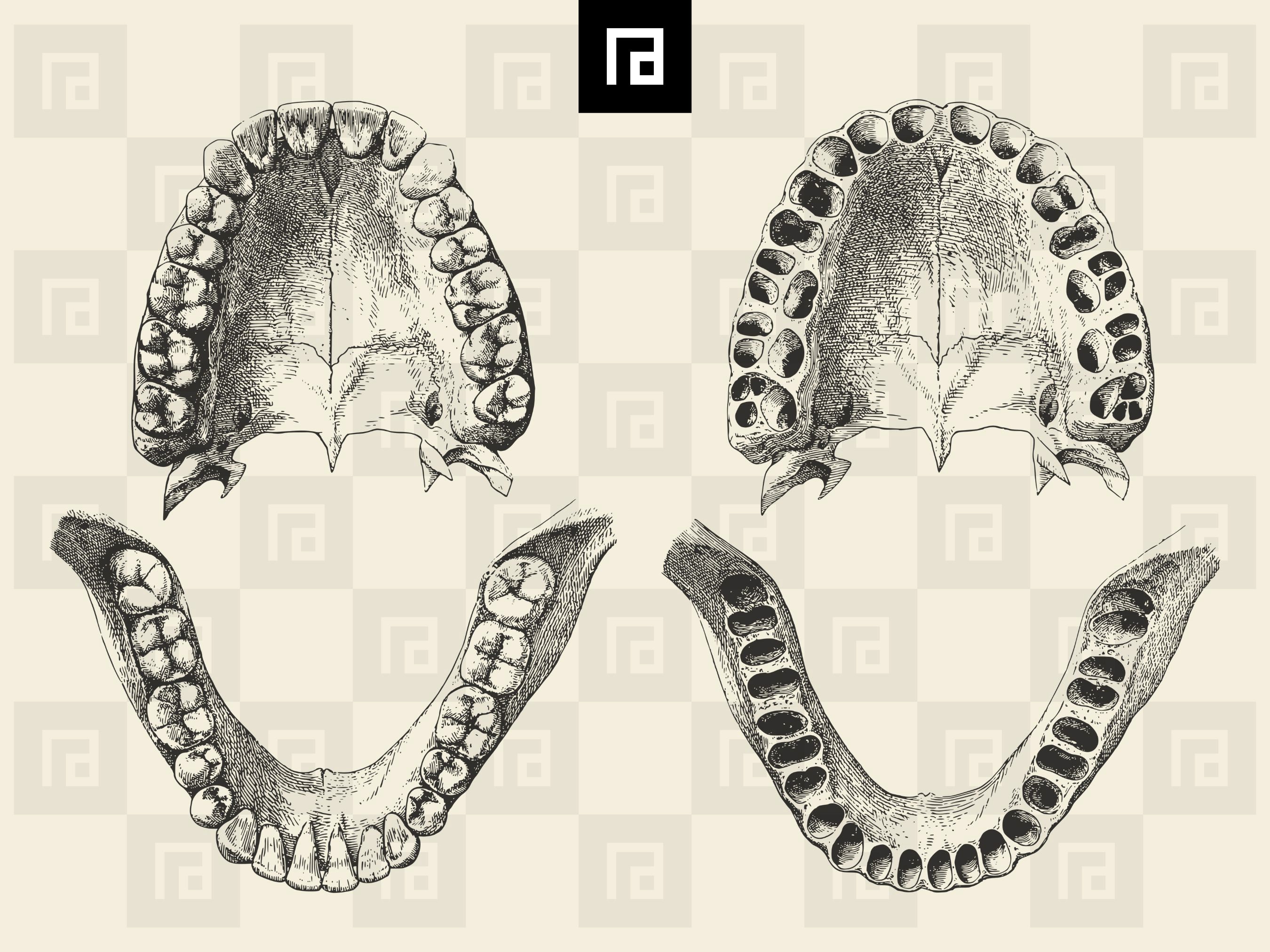 Human Teeth SVG PNG Bundle 2, Hand Drawn Full Arch of 32 Teeth Clipart ...