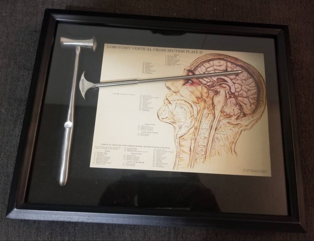 Lobotomy Shadowbox - Etsy