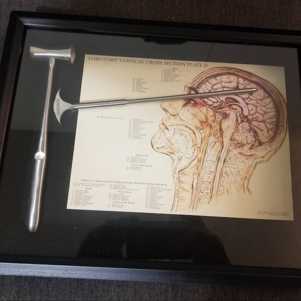 Lobotomy Kit - Etsy
