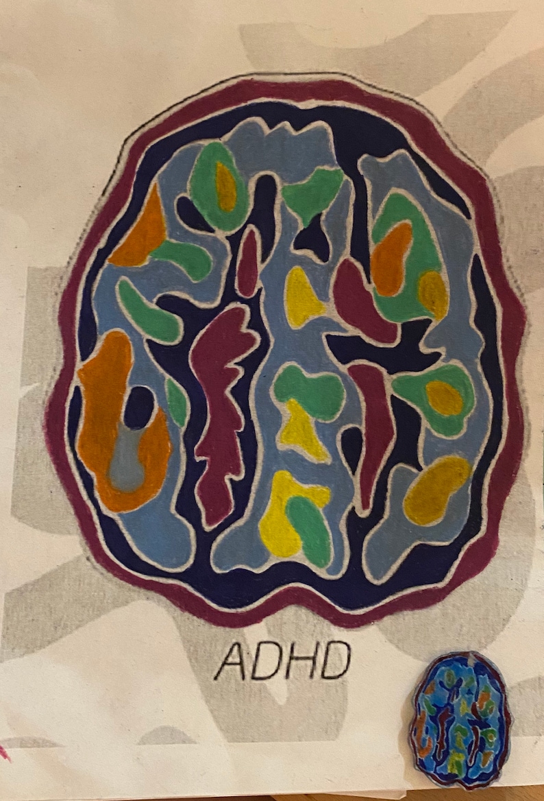 ADHD PET Scan Keychain - Etsy