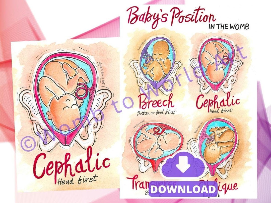 Fetal Baby Womb Positions Print: Antenatal Education Handout (PDF ...