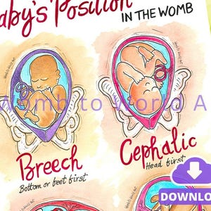 Fetal Baby Womb Positions Print: Antenatal Education Handout (PDF ...