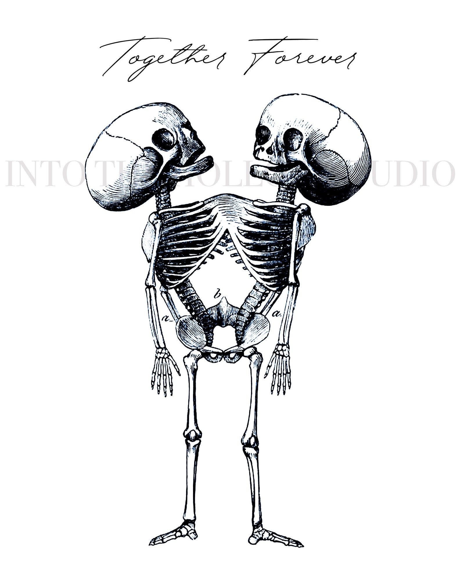 Insieme Forever Conjoined Twins Skeleton Digital Print / | Etsy Italia