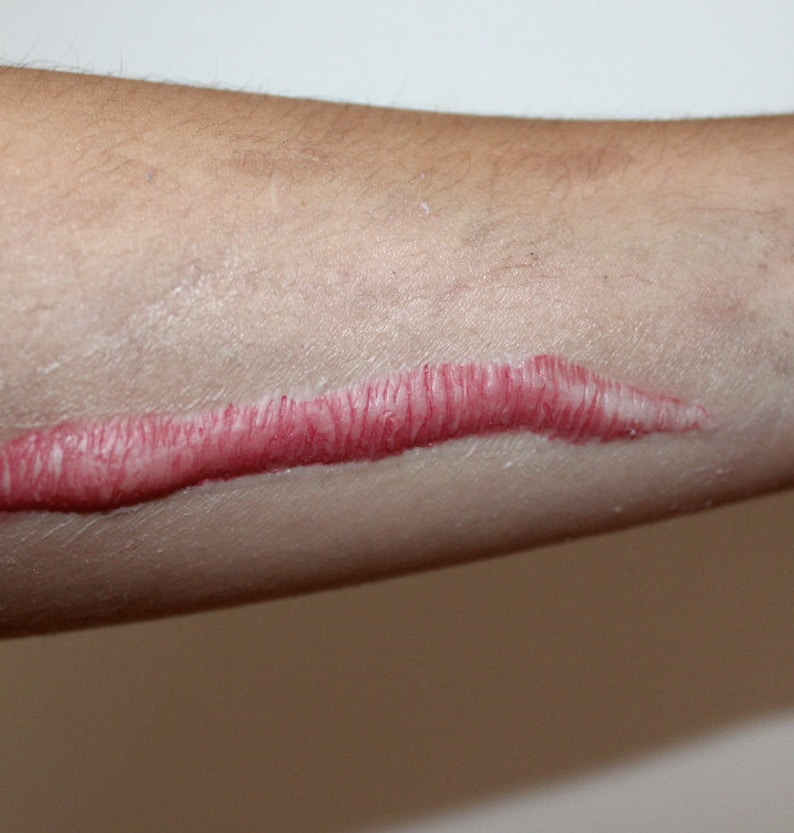 Hyper Realistic Thick Raised Keloid Scar Silicone Prosthetic - Etsy