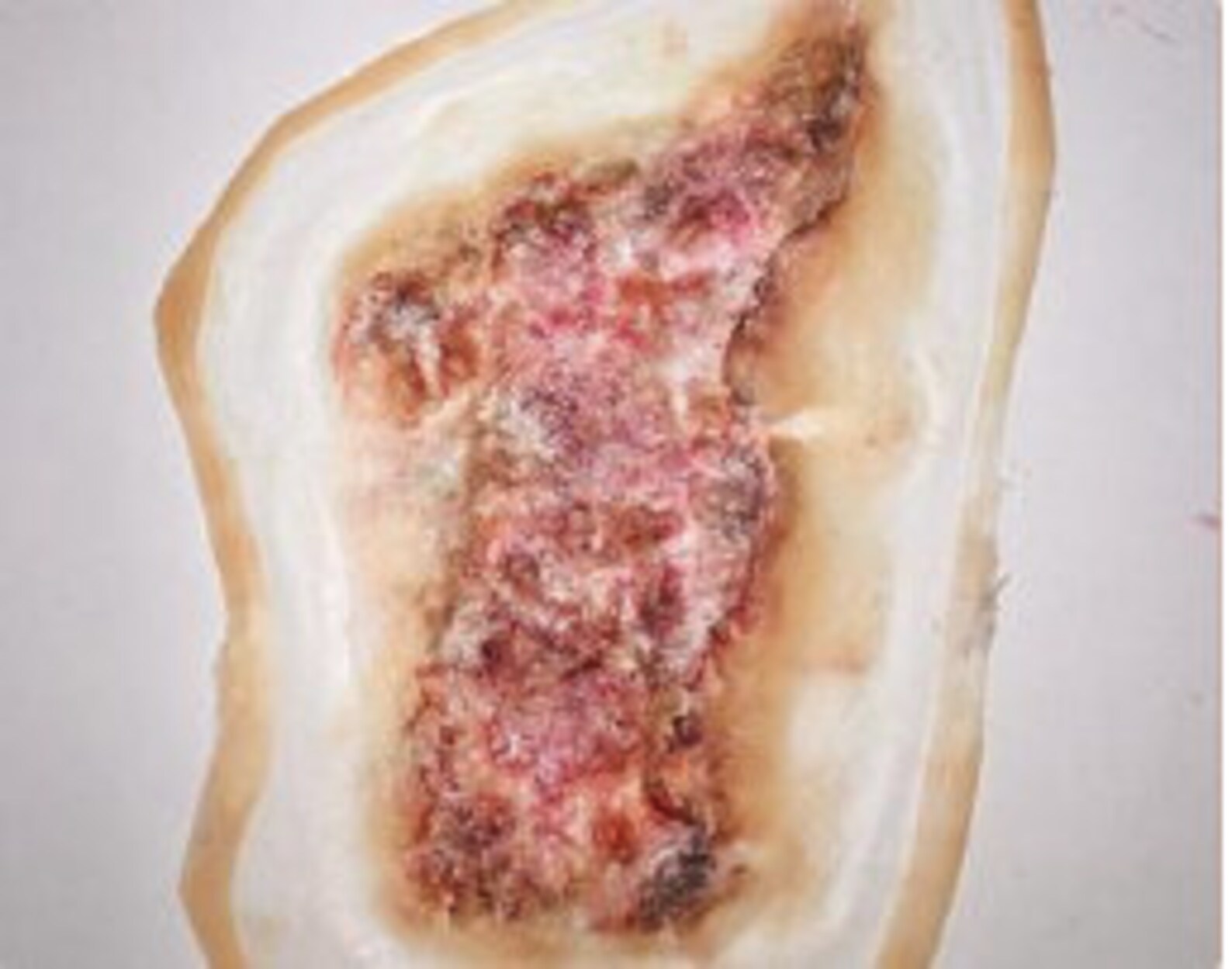 Infected/Burn Prosthetics Bundle for Film & TV Halloween and | Etsy