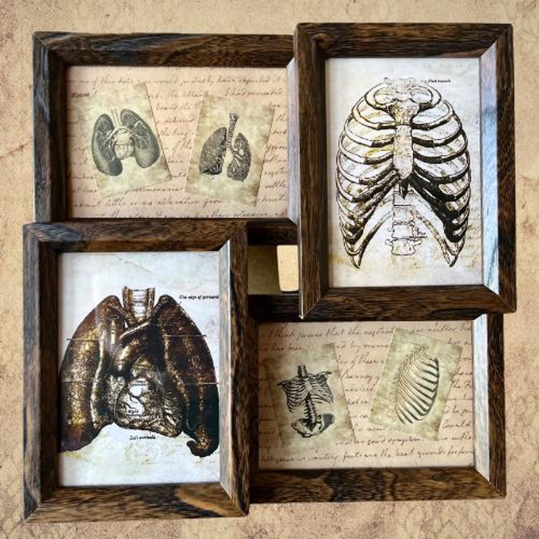 Antique Lungs and Ribs Collage Frame Medical Diagram. Autopsy, Surgery ...