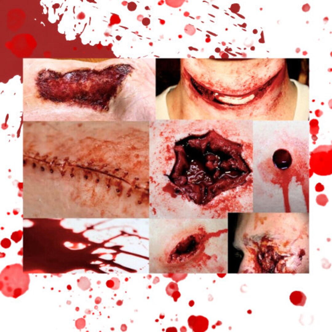 Emergency Room Prosthetic Bundle for Film, TV, Special Effects Makeup ...