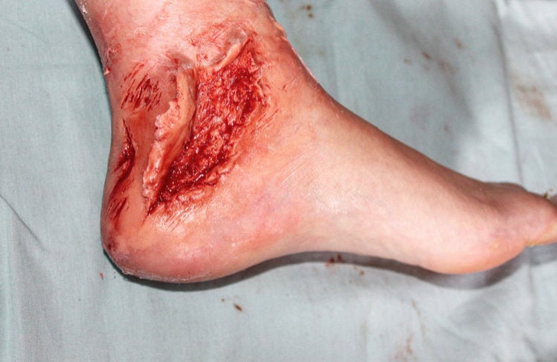 Deep Laceration Wound With Skin Peeling Back Prosthetic for | Etsy