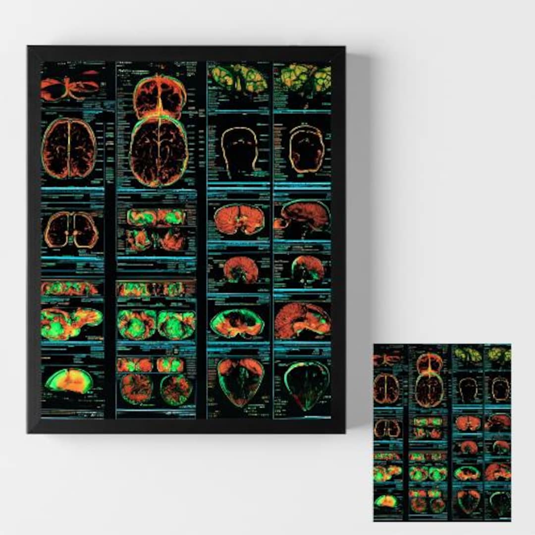 MRI Brain Chart Hologram Artwork Patient Forensic Autopsy Crime Digital ...