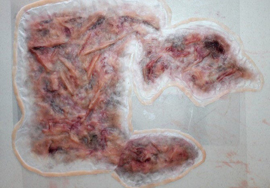 Large Skin Burn Silicone Prosthetic With Synthetic Burn Pus Gel for ...