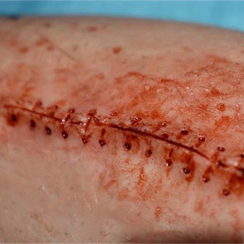 Stitched Wound Prosthetic Stitches Gore SFX Makeup - Etsy
