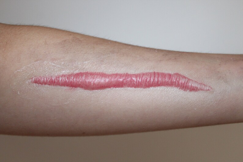 Hyper Realistic Thick Raised Keloid Scar Silicone Prosthetic - Etsy UK