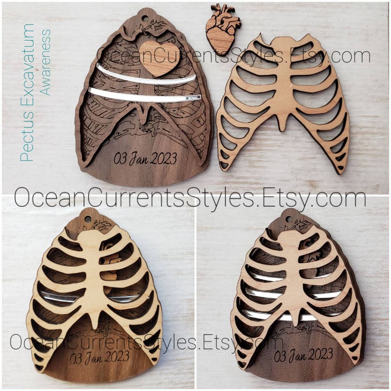 Pectus Excavatum Ornament, Nuss - Etsy