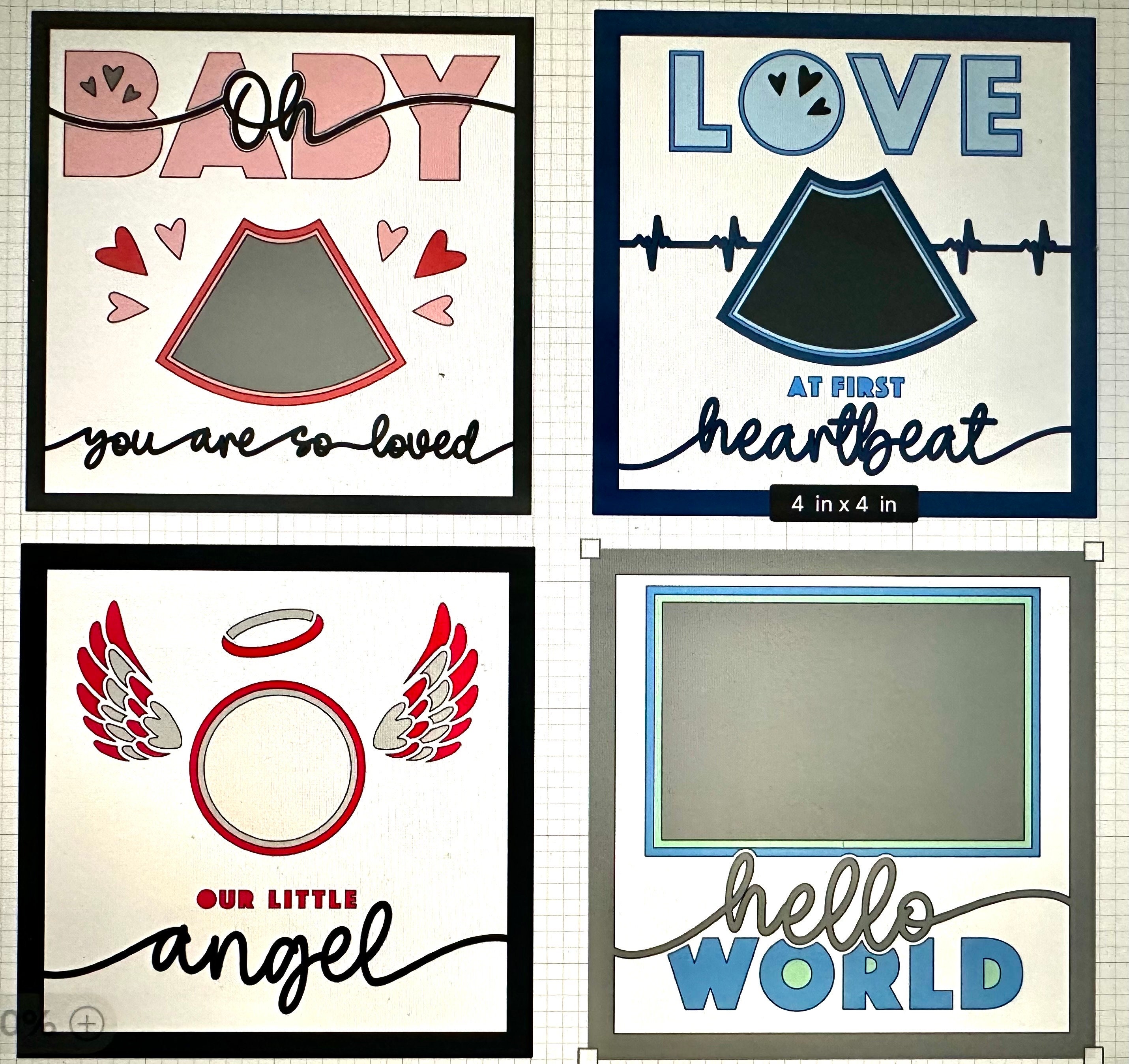 Baby Ultrasound 3D Picture Shadow Box - Etsy