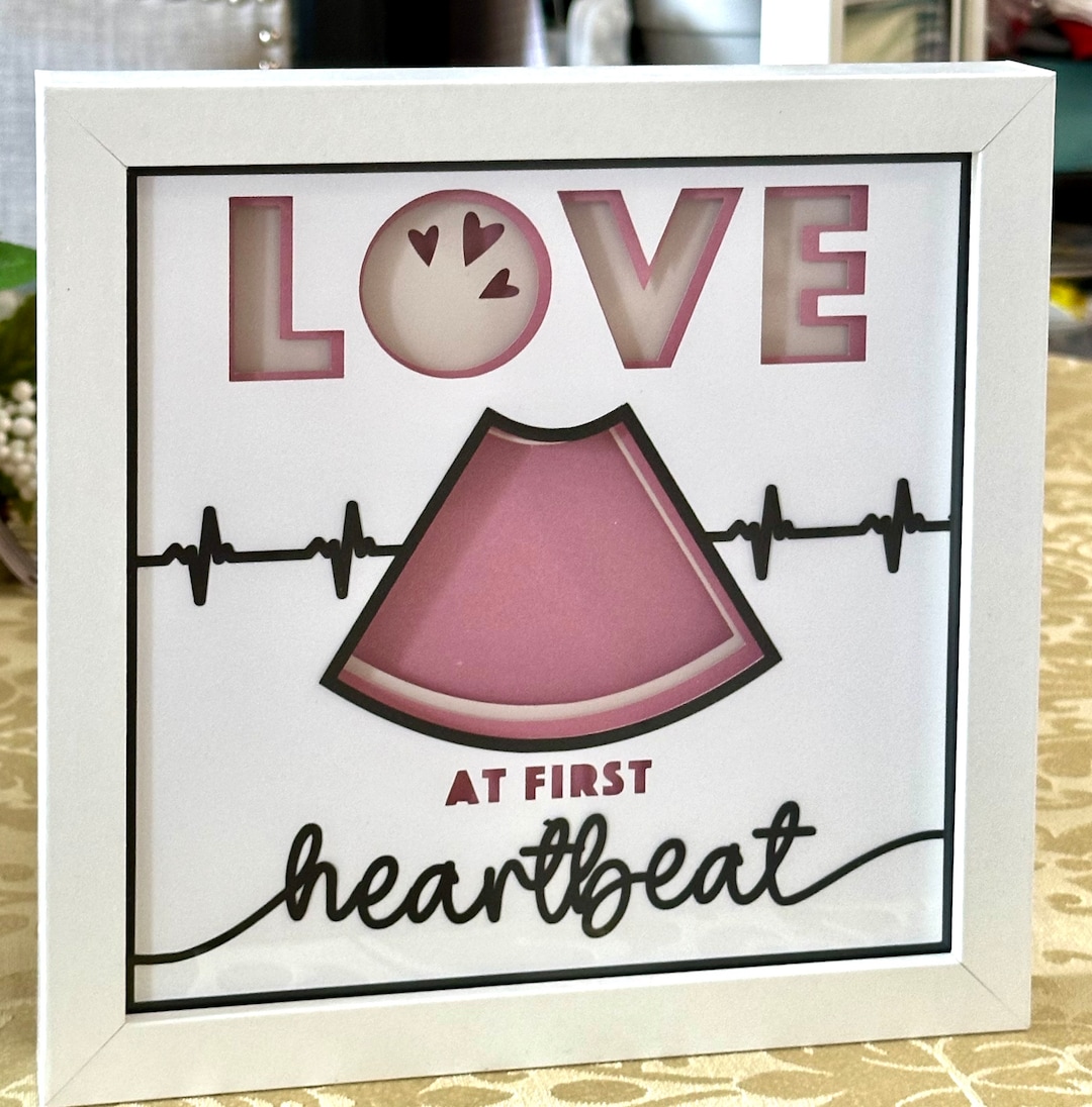 Baby Ultrasound 3D Picture Shadow Box - Etsy