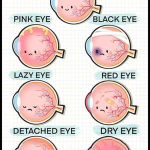 Eyeball Poster 11x17 - Etsy