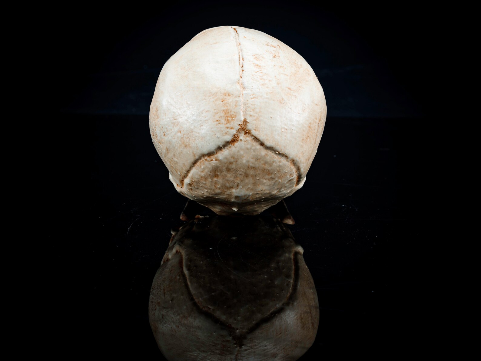 Fetal Skull With Craniosynostosis Human Skull Replica 3D - Etsy