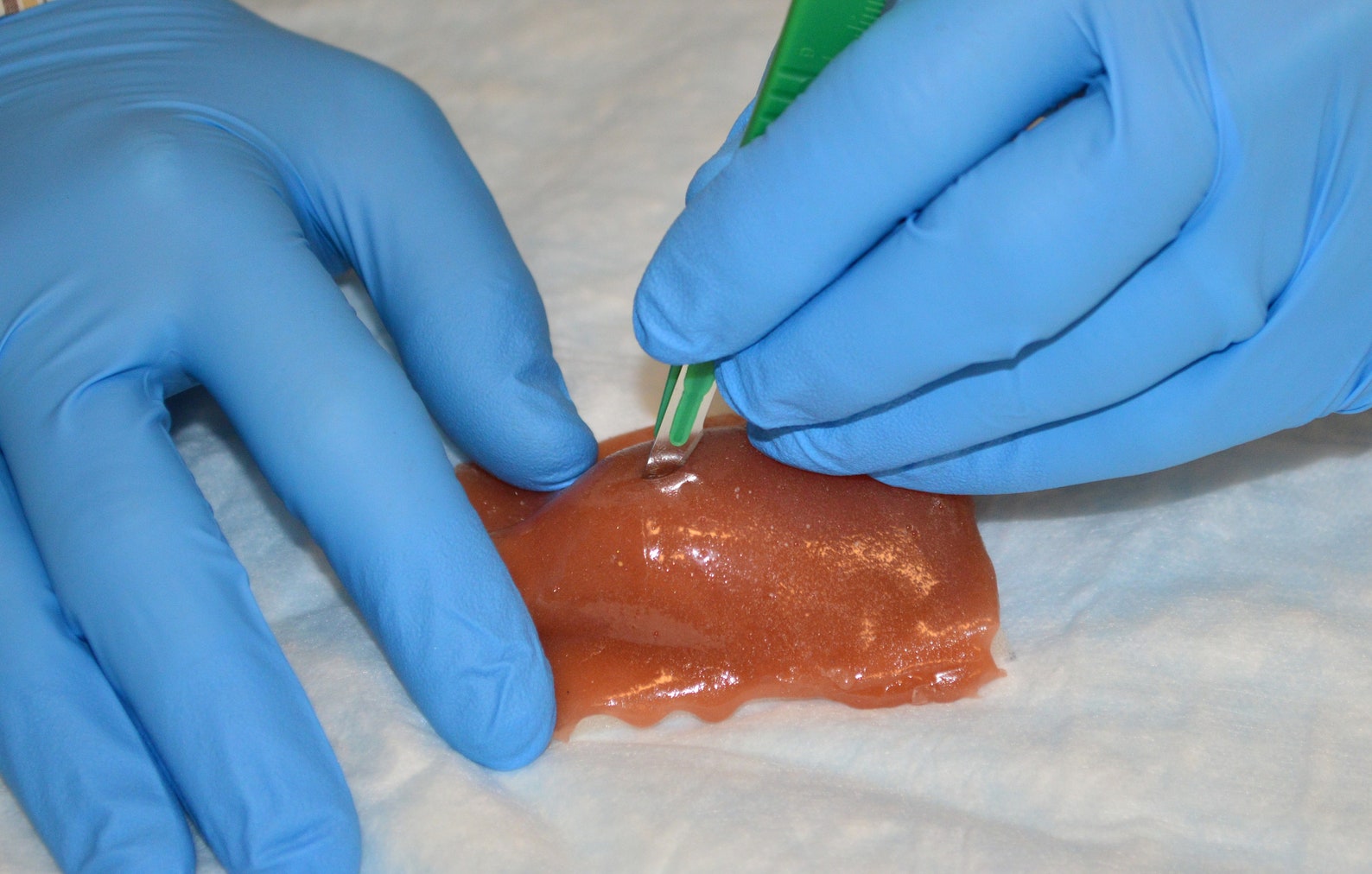 Abscess Incision Drainage Etsy Ireland Abscess Incision Drainage Etsy Ireland