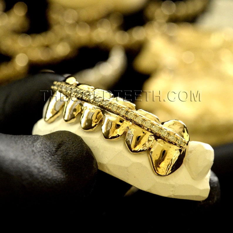 Grillz CZ Iced Out Yellow Gold Grillz Gold Teeth Real Custom - Etsy