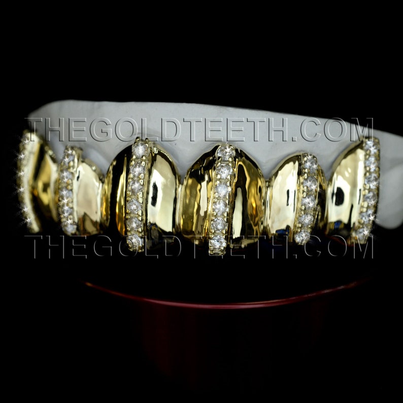 Grillz CZ Iced Out Yellow Grillz Custom Gold Teeth Real Gold - Etsy