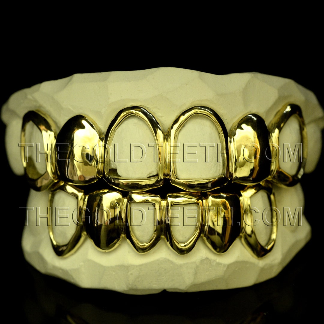 Custom Gold Grillz 10k Gold Teeth Open Face Yellow Grillz Real Gold ...