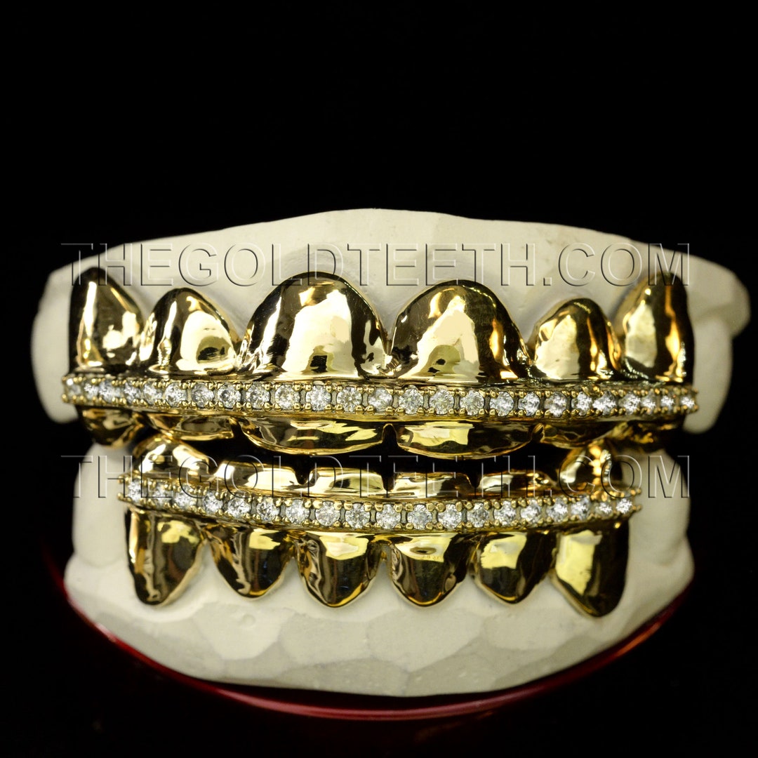 Grillz CZ Iced Out Yellow Gold Grillz Gold Teeth Real Custom Grill - Etsy