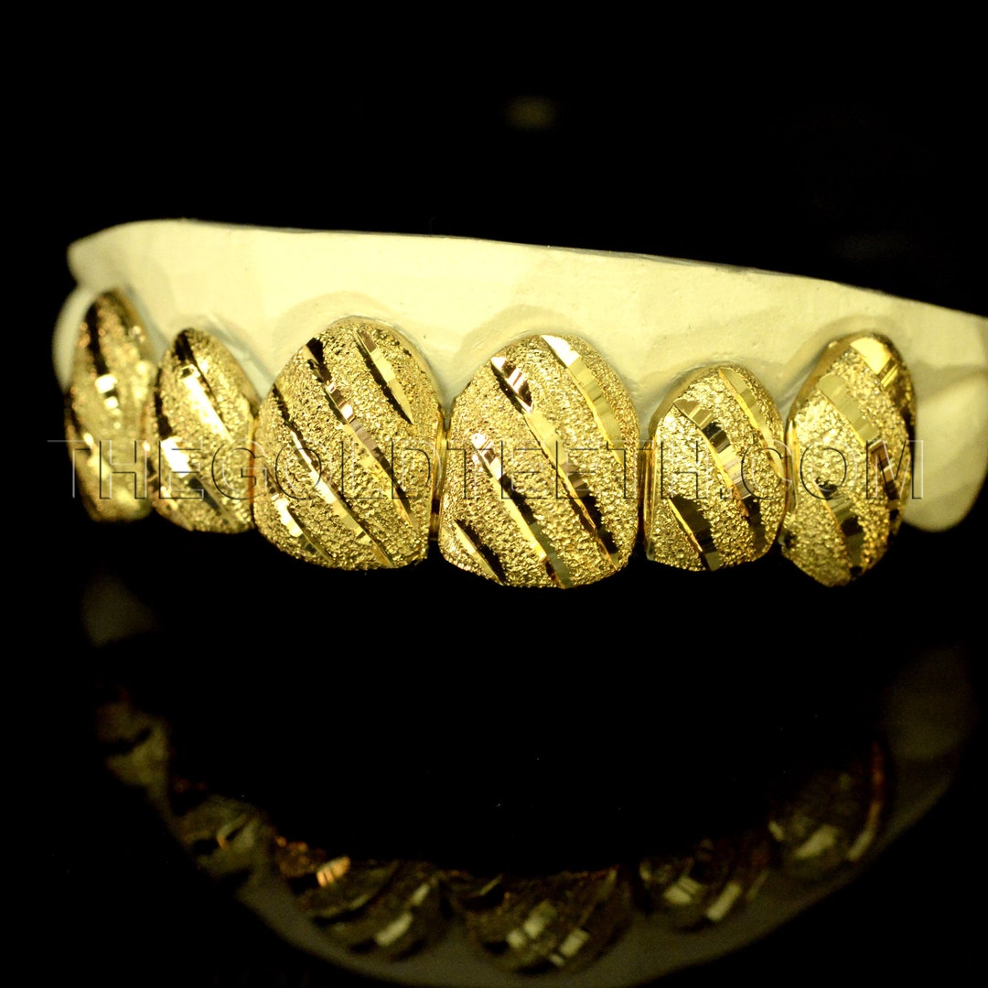 Custom Gold Grillz 10k,14k,18k Gold Teeth Diamond Dust Yellow Grillz ...
