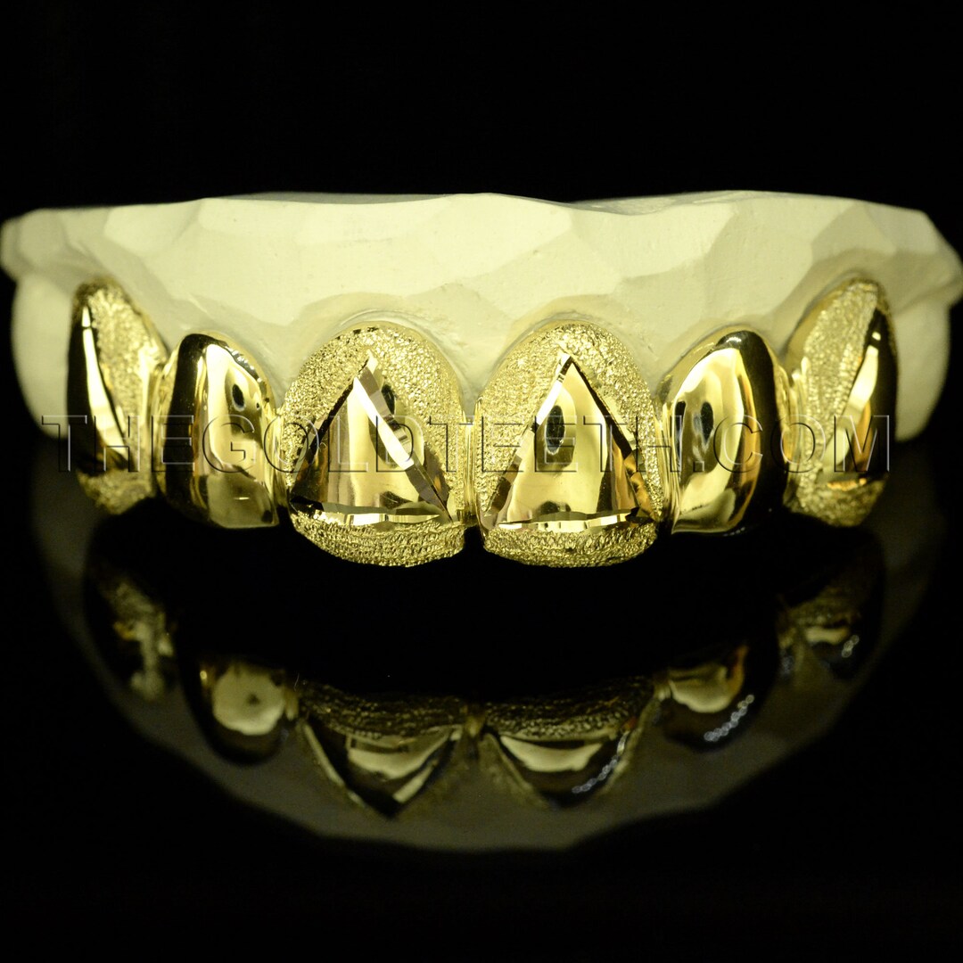 Gold Grillz 10k,14k,18k Custom Gold Teeth Diamond Dust Yellow Gold ...