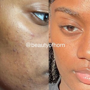 Authentic Somali Qasil( East African Face Mask-pore Refining + Fades ...