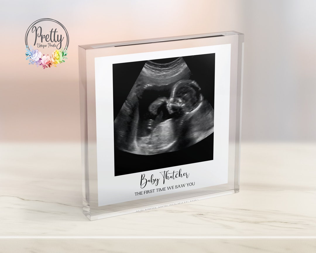 Personalised Baby Scan Photo Block, Baby Scan Photo Gift, Baby Shower ...