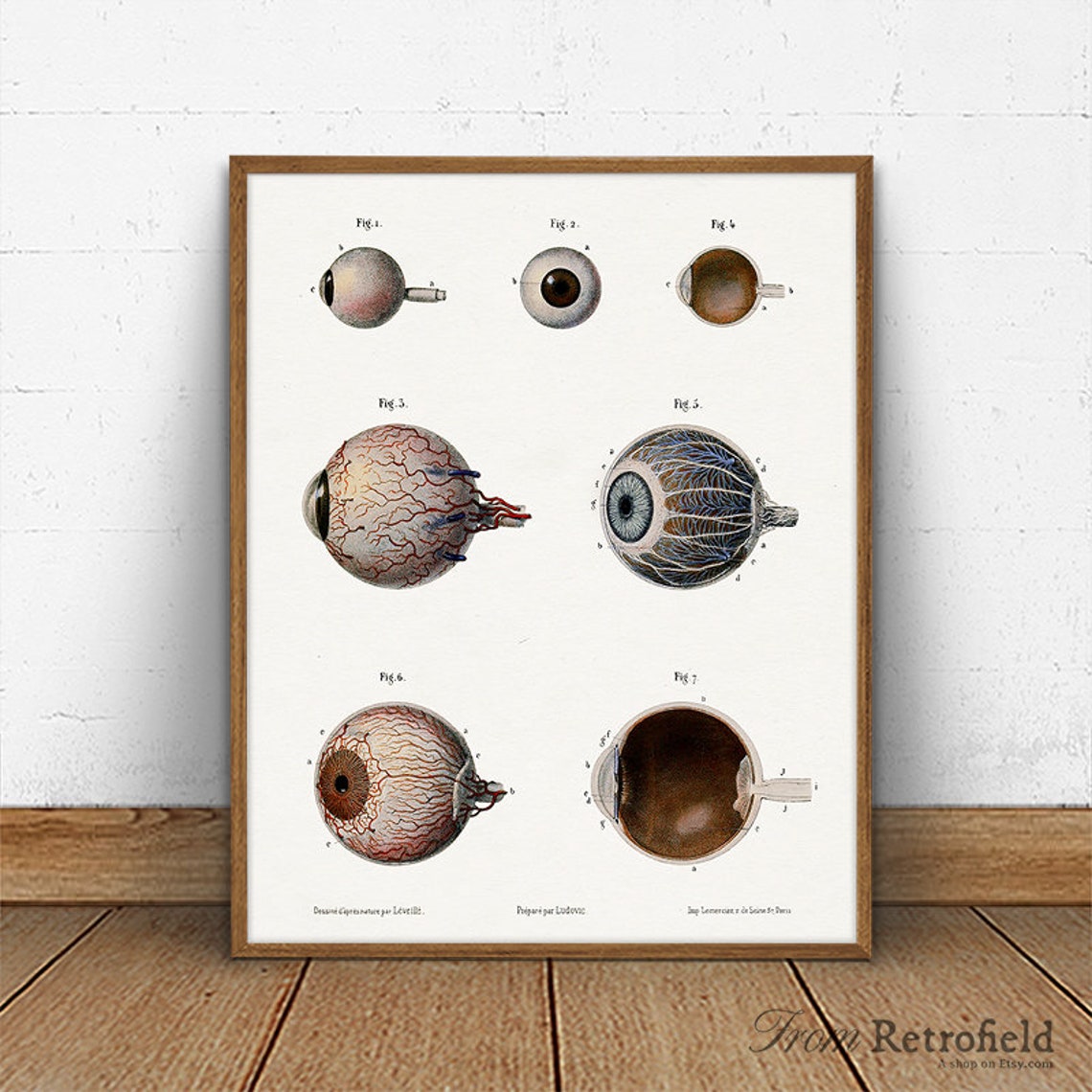 Human Eye Print Digital Download Optometrist Gifts Anatomy - Etsy