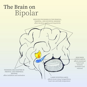 Bipolar Brain Diagram, Brain Digital Printable, Medical Science Art ...