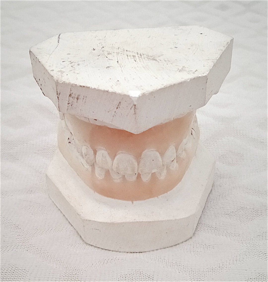 DENTURES TEETH Cast for Teeth Dental Technician in Vintage Plaster 80s ...