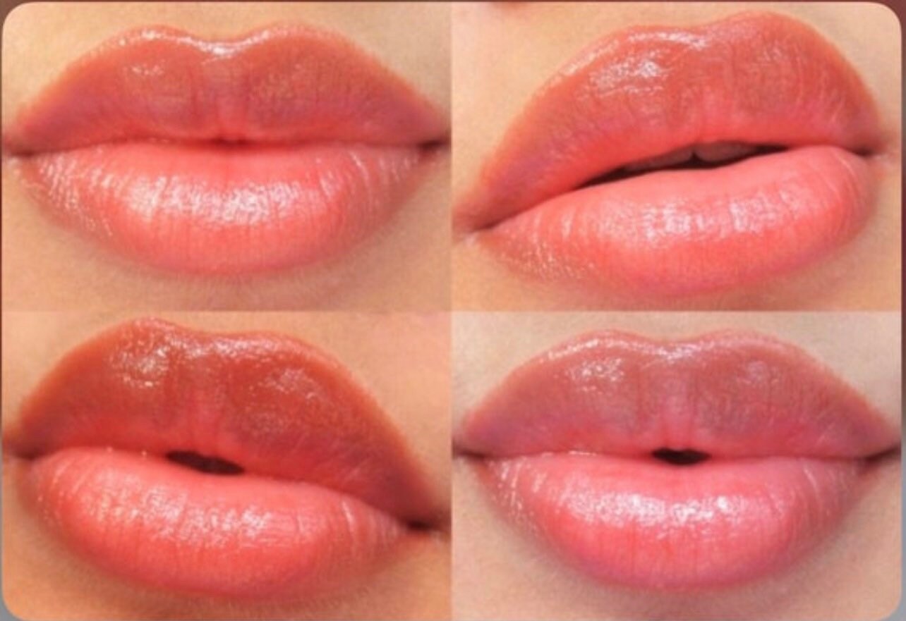 EXTREME PINK LIP Brightening Balm Solution, Permanent Pink Lip, Dark ...