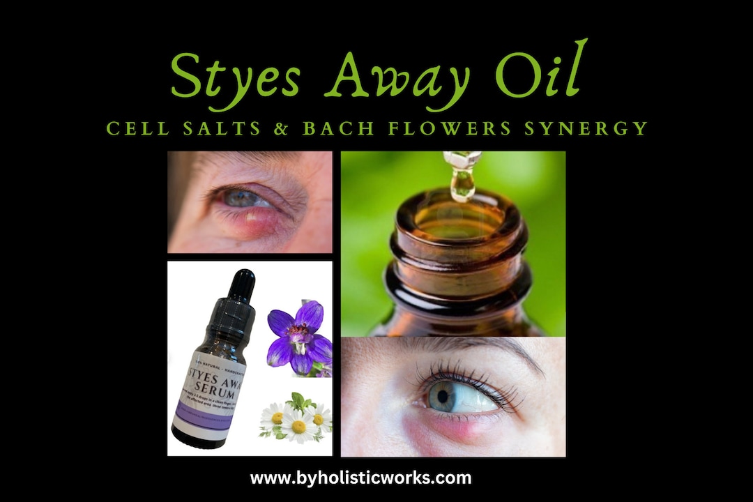 Styes Away Oil. Natural Soothing Oil. Cell Salts & Bach Flowers Infused ...