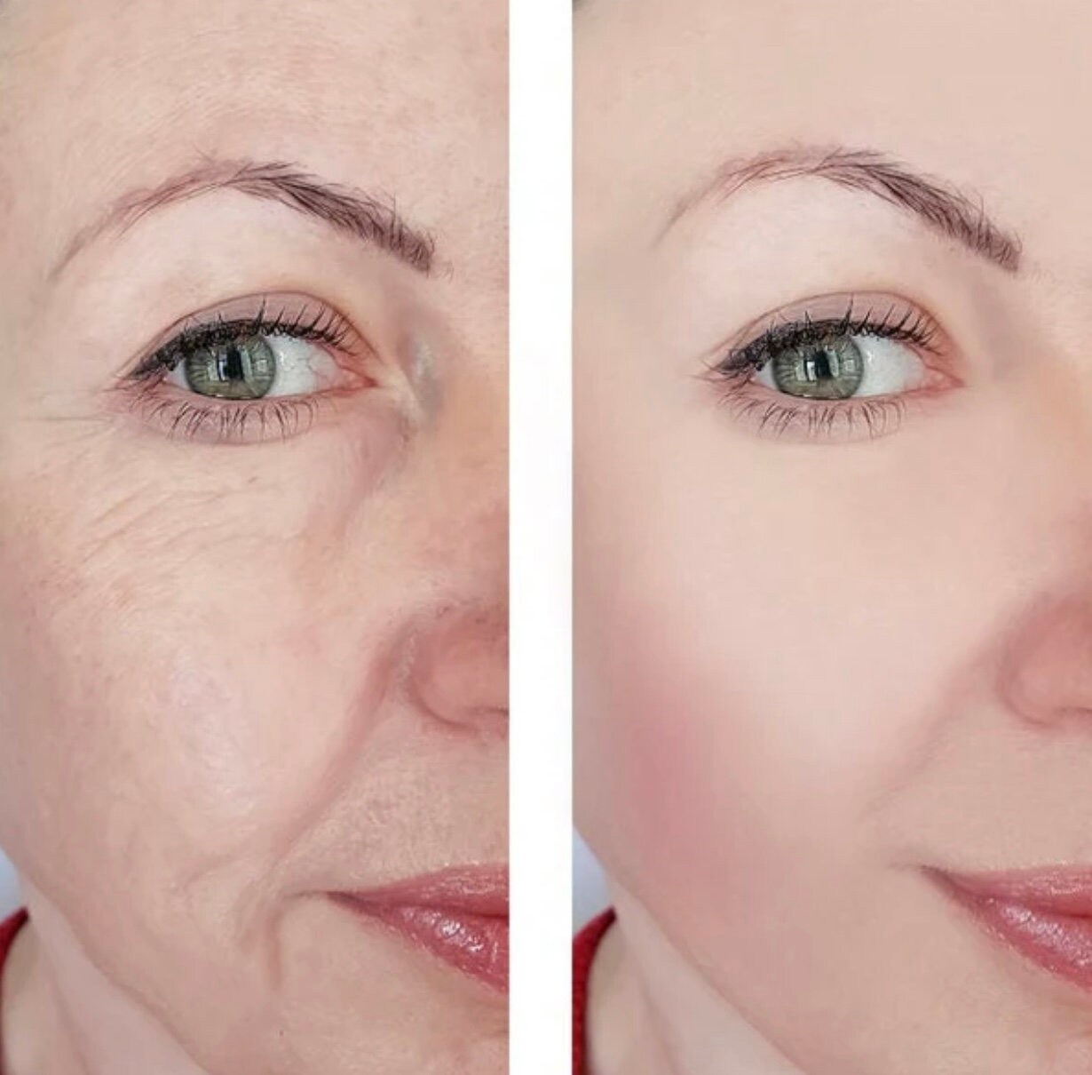 Hyaluronic Acid Liposome, Face, Moisturizer, Plump, Skin, Hydrate ...