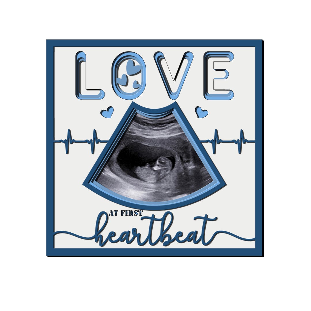 3D Baby Ultrasound Shadow Box SVG, Ultrasound Display Multi Layer Svg ...